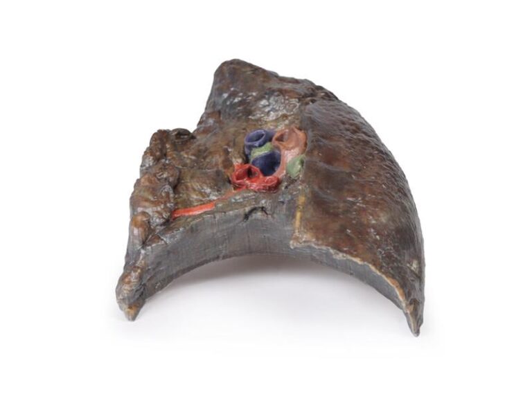 Modelo de Hilio del Pulmón Derecho - Medical Factory