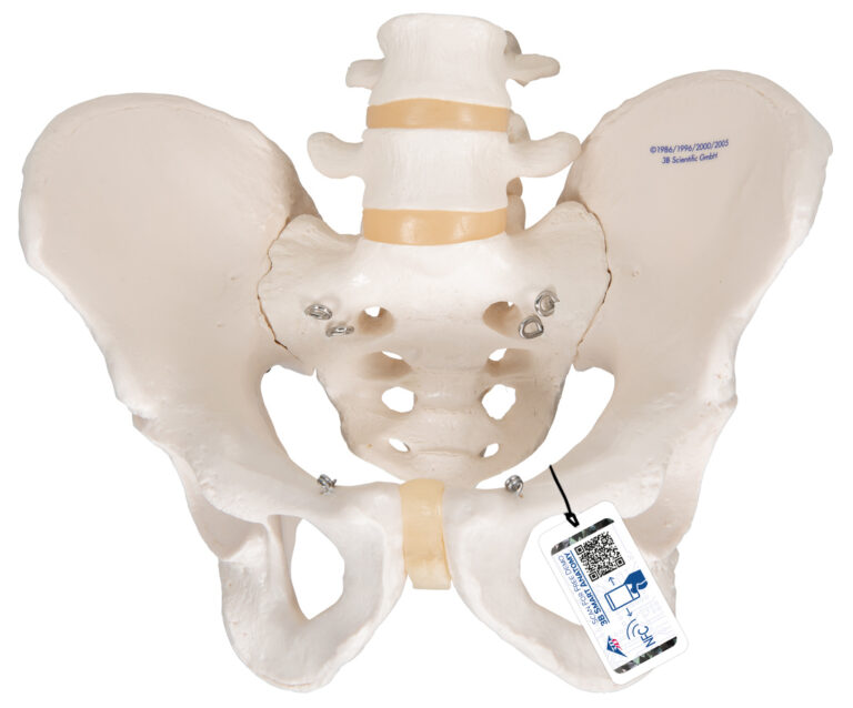 Modelos de Pelvis archivos - Medical Factory